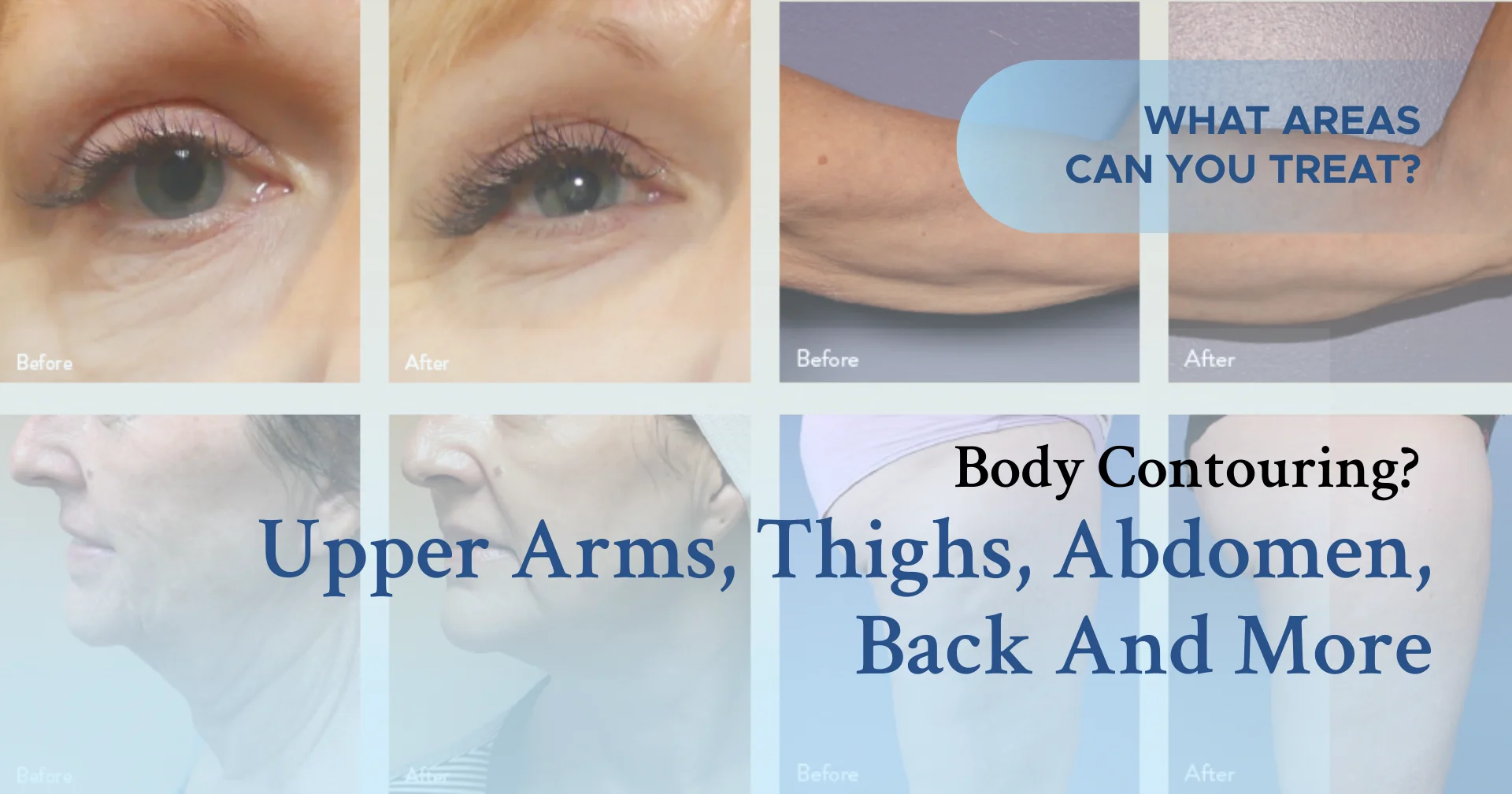 What Areas Can Body Contouring Treat? Abdomen, Arms, & Thighs